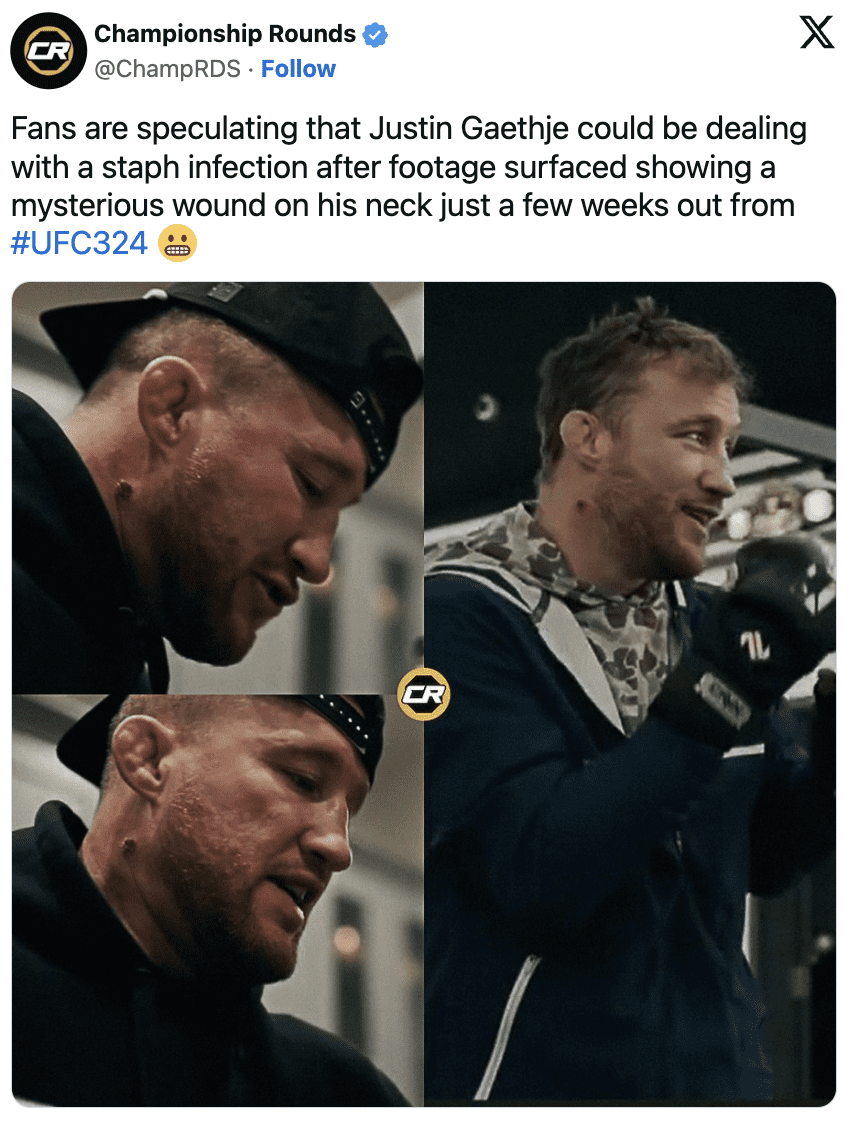 Sonnen Asks If Gaethje Is Hiding Staph Infection | MMA News